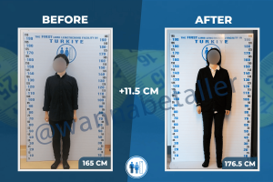 Average Height in Japan: Trends & Insights | Convert Master